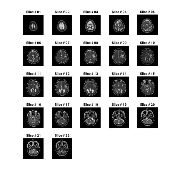 MRI Data Visualization · MATLAB for MRI Applications